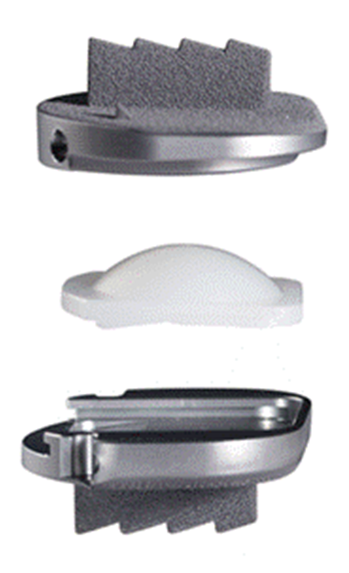 Artificial Lumbar Disc Surgery - Reno Orthopedic Center