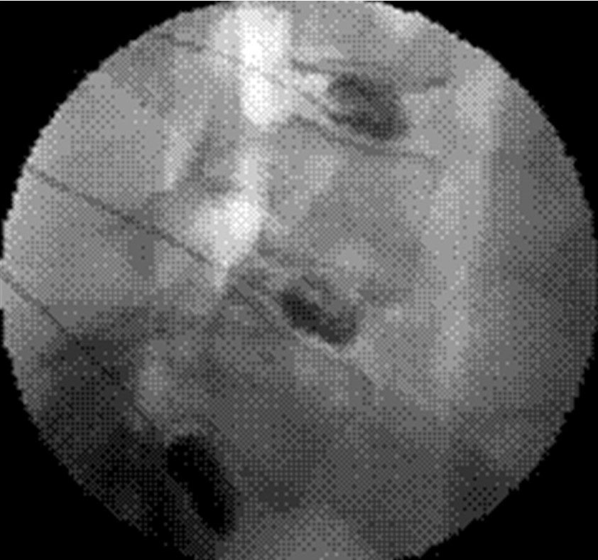 Spinal Injections | Purpose, Types & Procedure | ROC