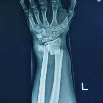 Markus Loeffler, MD - Reno Orthopedic Center